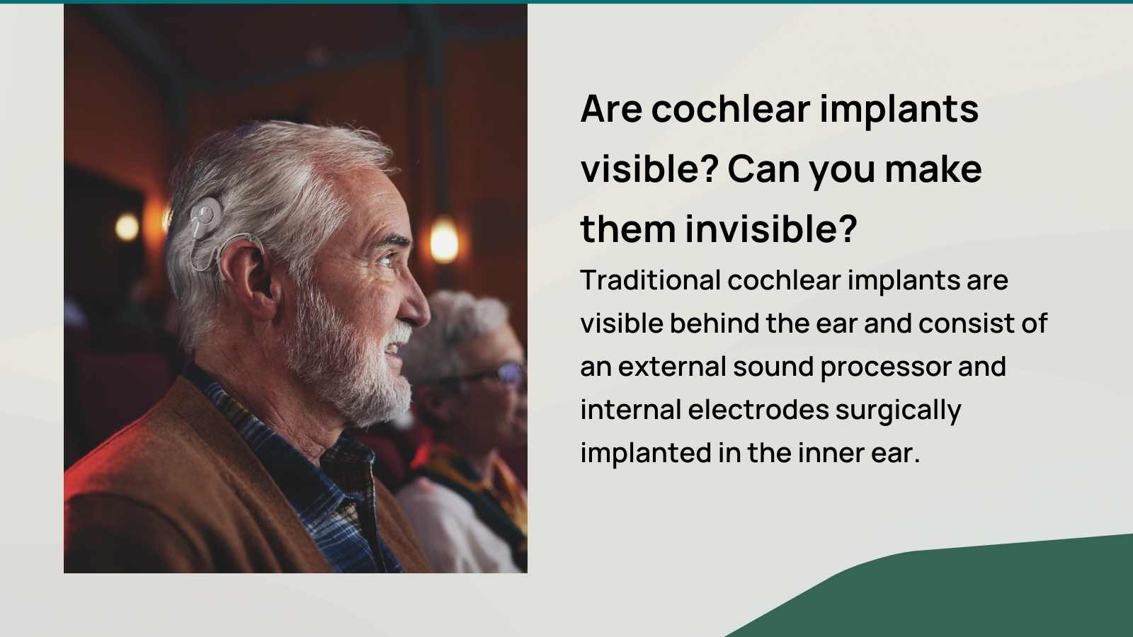 Invisible Cochlear Implants and Alternatives, Explained